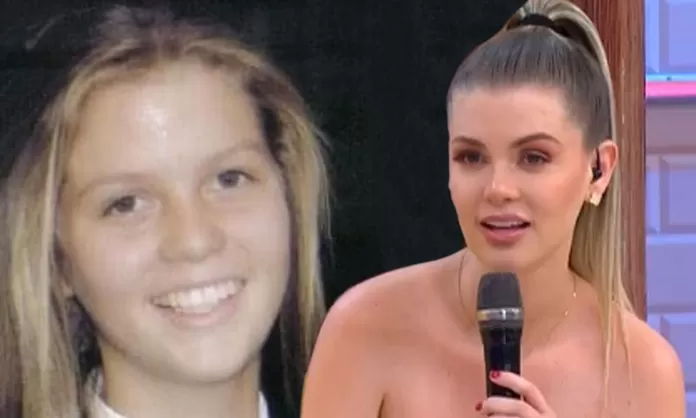 Fotos antes y después de Brunella Horna