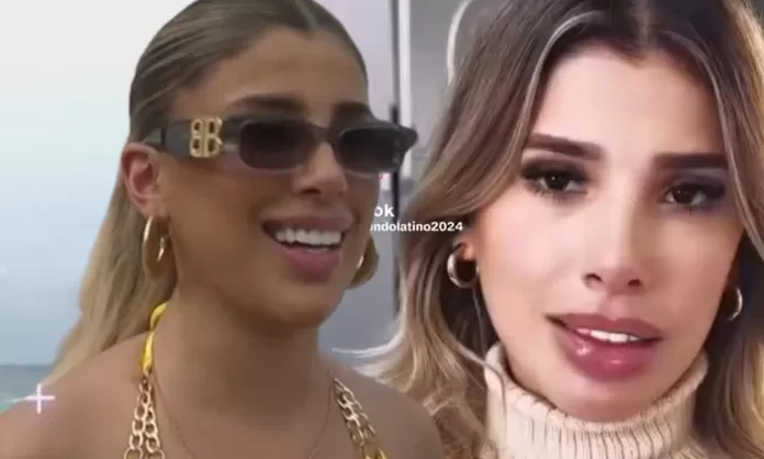 Yahaira Plasencia reveló los 'retoquitos' que se hizo en el rostro