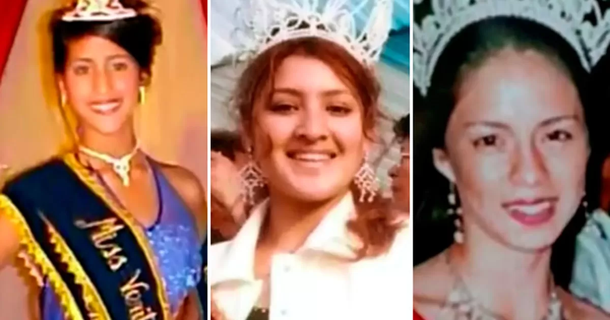 Antes y después de las operaciones de nariz a modelos peruanas ...