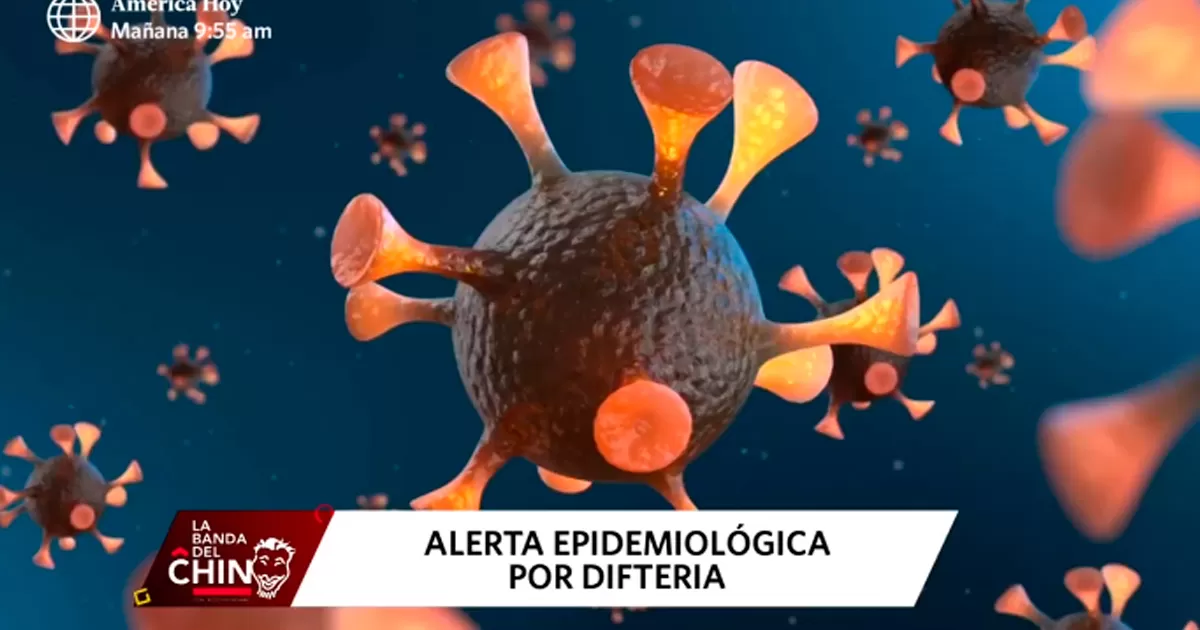 Difteria: ¿qué órganos ataca la letal bacteria en el cuerpo? | América ...