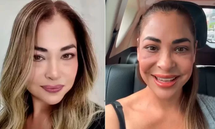 Melanie lució retoque en medio de polémica con Domínguez