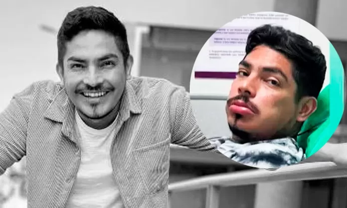 Erick Elera sufrió terrible intoxicación y lució irreconocible
